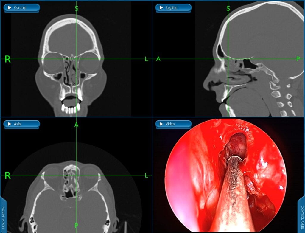 Ear Nose And Throat Specialists Surgeries